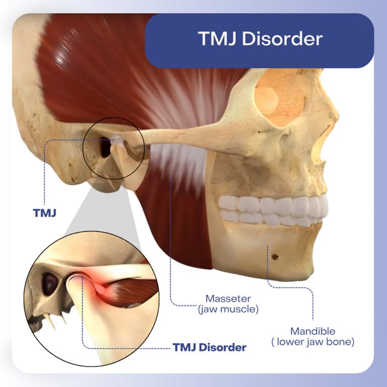 Temporomandibular Joint | Jaiswal Dental Care & Implant Centre